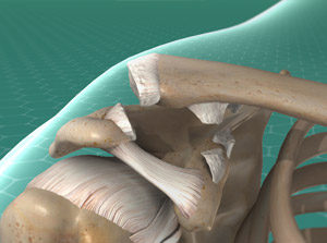 Acromioclavicular (AC) Joint Separation Repair - Willis Knighton Health ...