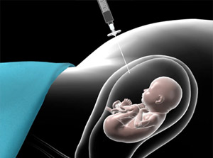 Amniocentesis - Willis Knighton Health - Shreveport - Bossier City ...