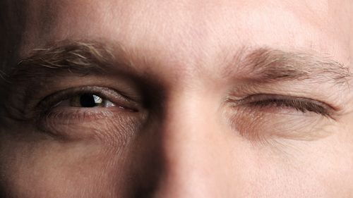 Blepharospasm - Willis Knighton Health - Shreveport - Bossier City ...