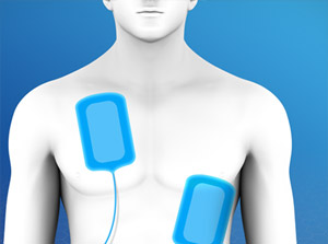 Cardioversion (Electrical) - Willis Knighton Health - Shreveport ...