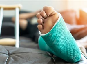 Caring for Your Cast