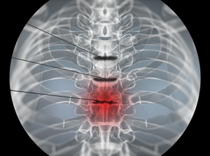 Discography (Lumbar) - Willis Knighton Health - Shreveport - Bossier ...