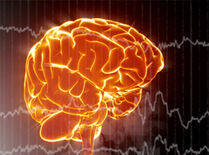 Electroencephalogram (EEG)