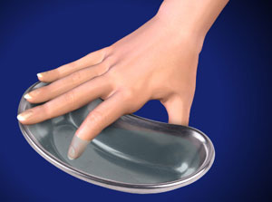 Finger Felon Drainage - Willis Knighton Health - Shreveport - Bossier ...