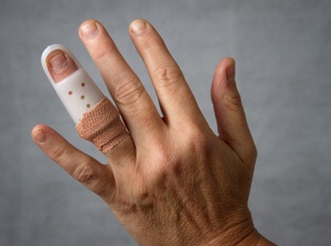 Finger Fracture