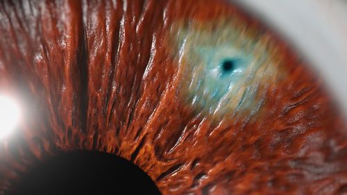 Laser Peripheral Iridotomy (LPI) - Willis Knighton Health - Shreveport ...