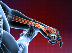 MRSA (Methicillin-Resistant Staphylococcus Aureus) Infection - Willis ...