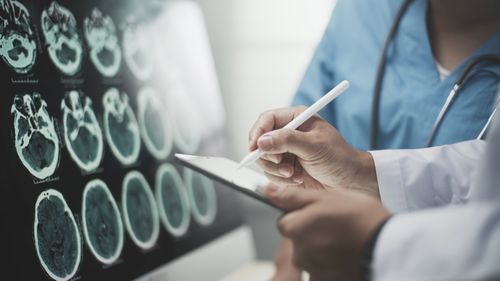 Multiple System Atrophy (MSA)