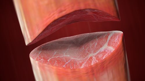 Complete Muscle Tear - Willis Knighton Health - Shreveport - Bossier ...