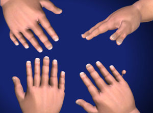 Polydactyly of the Hand - Willis Knighton Health - Shreveport - Bossier ...