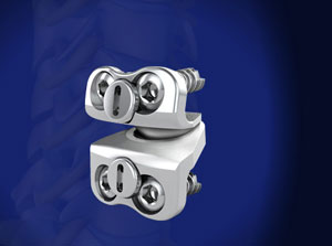 Artificial Cervical Disc Replacement (Prestige®) - Willis Knighton ...