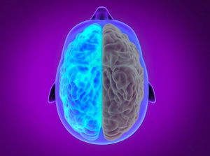 Right Brain Stroke - Willis Knighton Health - Shreveport - Bossier City ...