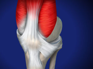 Mini Incision Total Knee Replacement - Willis Knighton Health ...