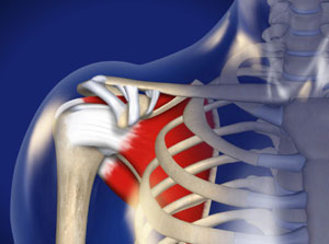Ultrasound-Guided Injection for Shoulder Pain - Willis Knighton Health ...