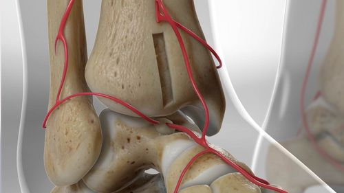 Vascularized Bone Graft for Avascular Necrosis of the Talus - Willis ...