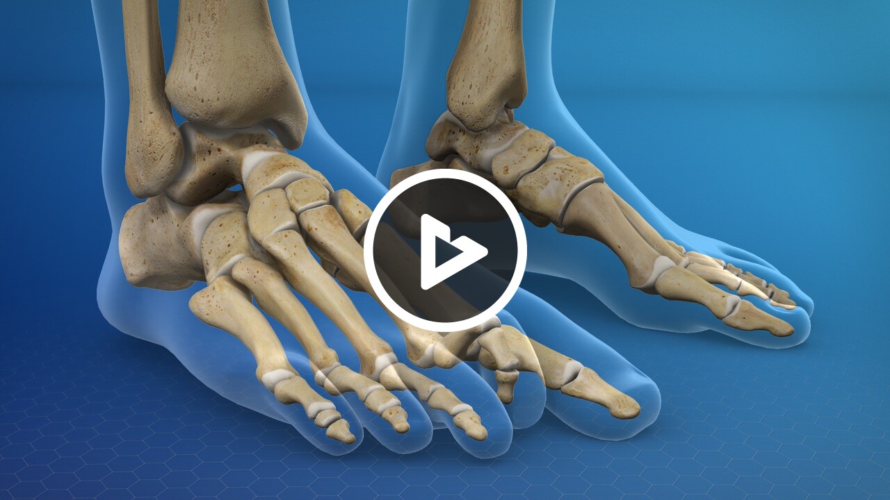 Claw Toe - Disease & Condition Information - Willis Knighton Health ...