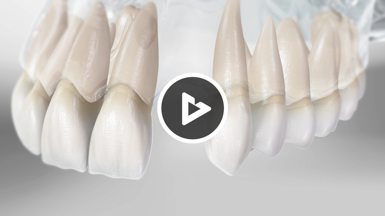 Tooth Extraction - Health Resources - Willis Knighton Health - Top ...