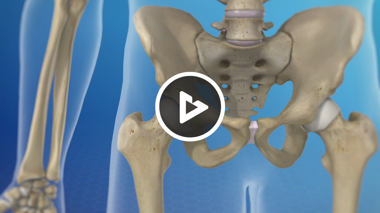 Anatomy of the Hip Joint - Hips - Willis Knighton Health - Top ...