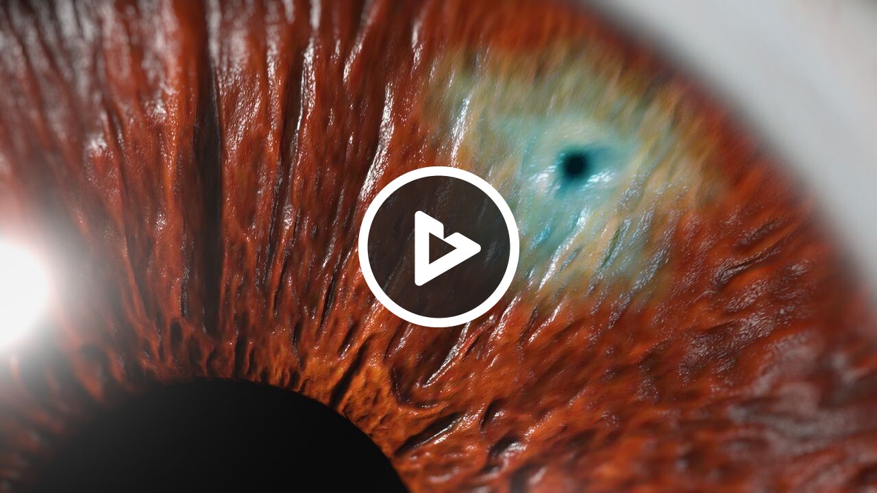 Laser Peripheral Iridotomy (LPI) - Medical Procedures, Tests, Care and ...