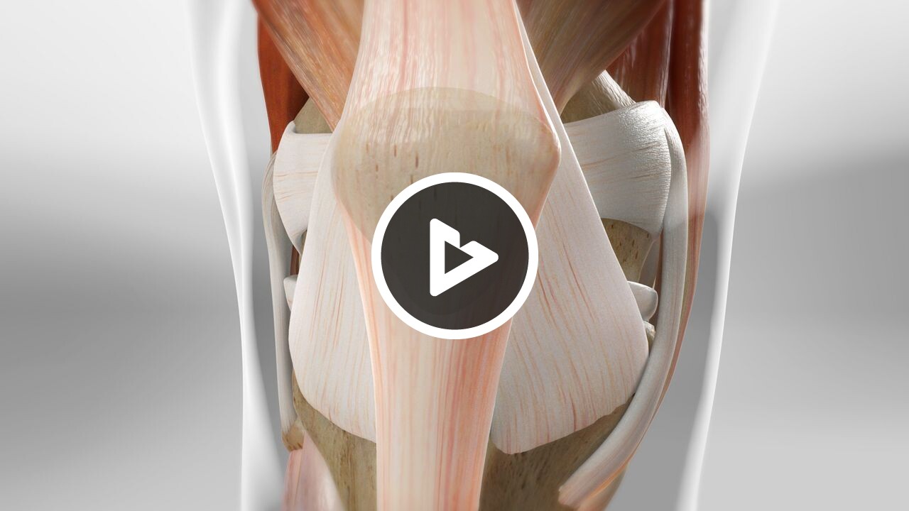 Surgery for Patellar Tracking Disorder (Lateral Release and Medial ...