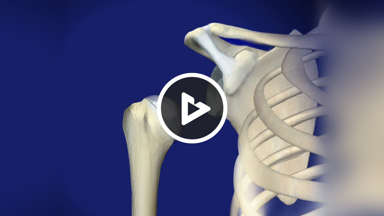 Shoulder Resurfacing - Medical Procedures, Tests, Care and Management ...